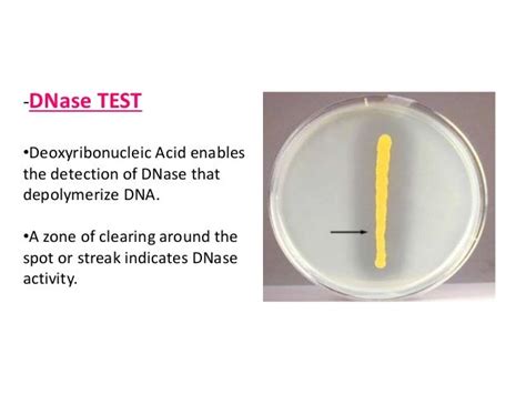 Staphylococcus Aureus