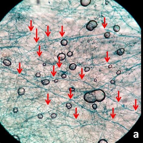 Pdf Mycoparasitism Of Trichoderma Spp Against Phytophthora Capsici And Rhizoctonia Solani