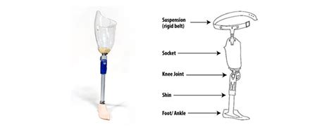 Rehabilitation For Lower Limb Amputees Fv Hospital
