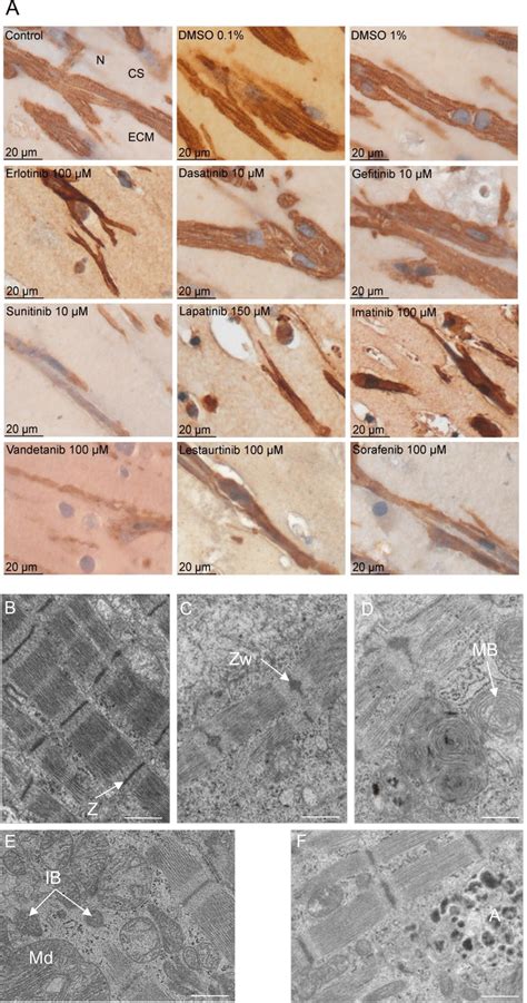 A α Sarcomeric Actin Staining Of Longitudinal Eht Sections In The