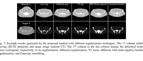 example results generated by two baseline methods syn and voxelmorph