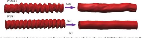 Figure 12 From An Unsupervised Deep Learning Framework For Retrospective Gating Of Catheter