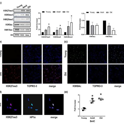 Chip Seq Reveals Differential Roles Of H3k27me3 And H3k9ac In Skeletal