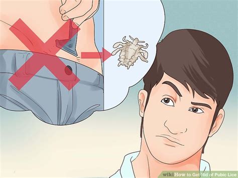 Ways To Get Rid Of Pubic Lice WikiHow