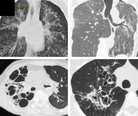 Ct Quick Guides Ct Scanning