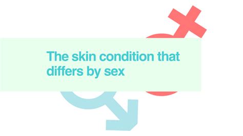 The Skin Condition That Differs By Sex