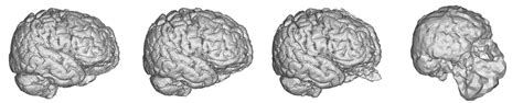 Visualisation Of Predictions From 3d Benchmark Brain Models And Fsl