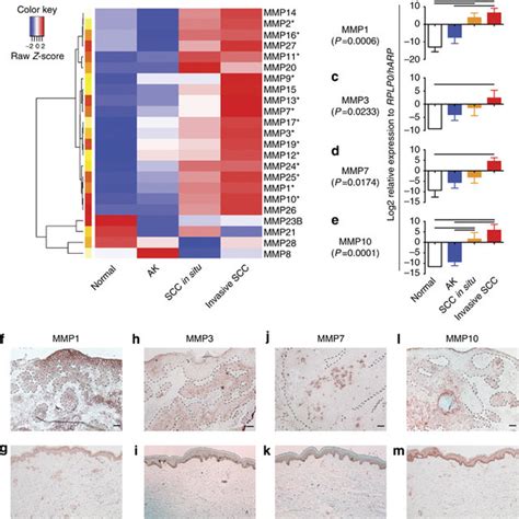 Combined Laser Capture Microdissection Lcm And Complementary Dna