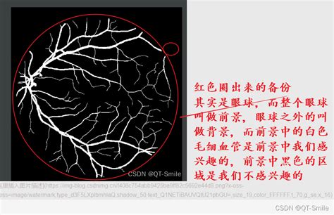 使用pytorch搭建u Net网络并基于drive数据集训练语义分割学习笔记 Csdn博客