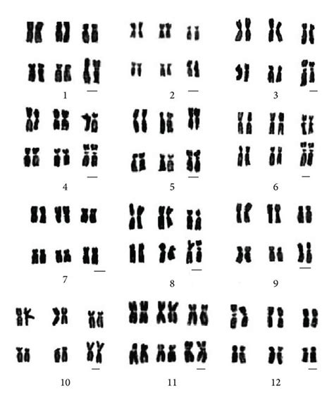 Karyotypes Of Twelve Species Metaphase Chromosomes All Species With 2n Download Scientific