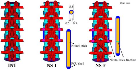 Three Finite Element Spine Models Were Established Intact Spine INT Download Scientific