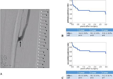 Arteriography 1 Year Postoperatively Revealed That The Femoro Anterior Download Scientific