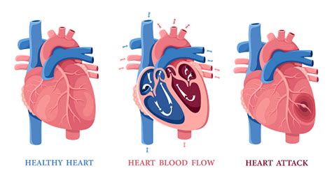 건강한 심장 심장 혈류 심장 마비 인간의 심장 해부학 심장에 대한 스톡 벡터 아트 및 기타 이미지 심장 하트 모양 인간의 심장 Istock