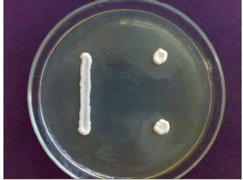 1562C0001000000034 1 酿酒酵母 微生物菌种 图片