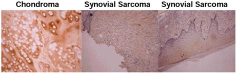 Osteocalcin Monoclonal Antibody Clone Oc4 30 Info Leinco Technologies