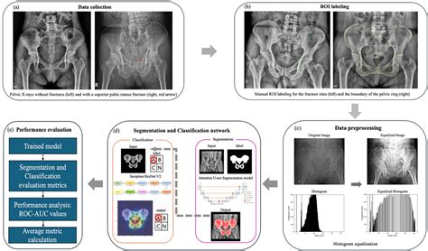 Automated Association For Osteosynthesis Foundation And Orthopedic