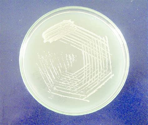 What Is Nutrient Agar Composition How To Prepare And Uses