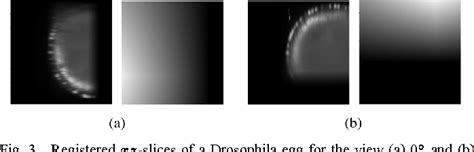 Figure 3 From Multiview Deblurring For 3 D Images From Light Sheet Based Fluorescence Microscopy