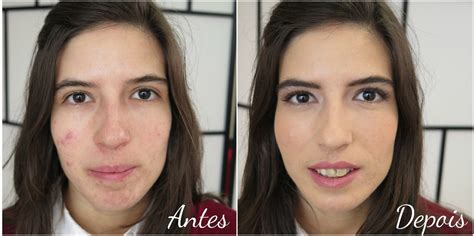 Maquilhagem Em Pele Acneica Rituais De Beleza