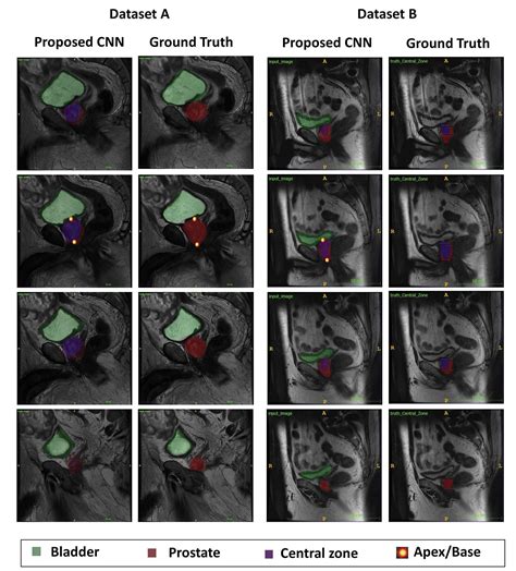 Multitasking Neural Networks For Multiplanar Mri Prostate Localization And Segmentation