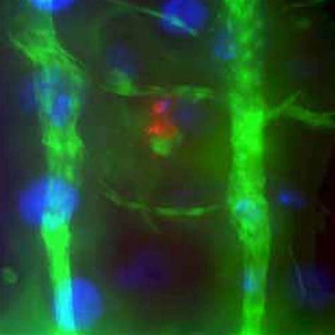 Asia Imaging Autoquant Deconvolution Imaging Solution Asia Imaging Autoquant Deconvolution Imaging Solution