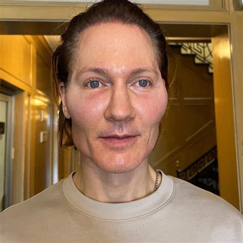 Anti Aging Guru Bryan Johnson Shows How His Attempt To Turn Back The