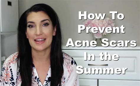 How To Prevent Acne Scars In The Summer Time Envision Skin Care Center PoreInfusion Acne How To Prevent Acne Scars In The Summer Time Envision Skin Care Center PoreInfusion Acne