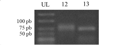 Experimental Validation Of Mirna Stem Loop Structure Through Rt Pcr Download Scientific Diagram