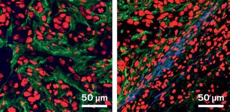 Visualizing Cross Linking In Collagen