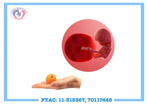 Жирэмсний долоо хоногууд Таны төлөө бид Эх барих эмэгтэйчүүдийн эмнэлэг