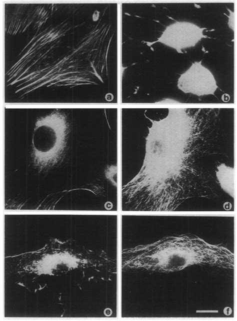 Localization Of F Actin A B C E Vimentin 4 And Tubulin E In