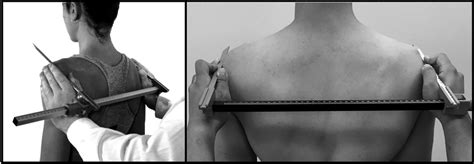 69 Measurement Of The Biacromial Breadth Download Scientific Diagram