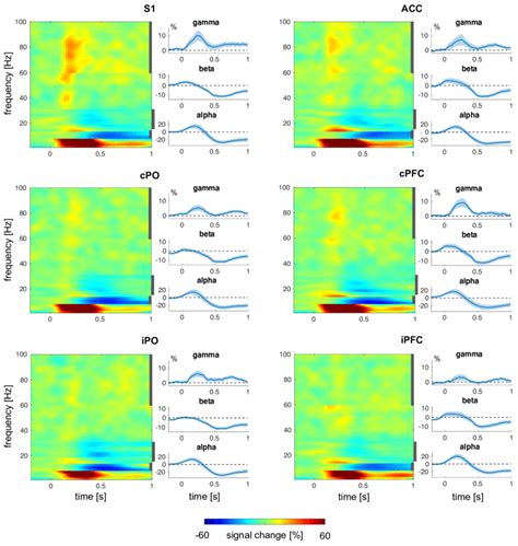 Time Frequency Representations Of Local Oscillatory Brain Activity In Download Scientific