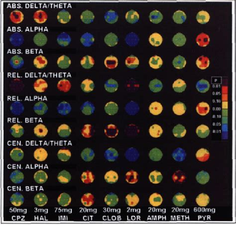 Table 1 From Eeg Topography And Tomography Loreta In The