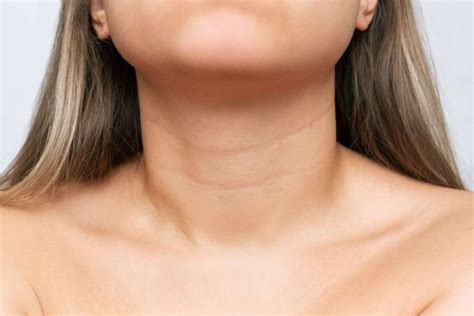 How To Get Rid Of Neck Lines Gluta C