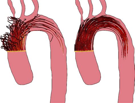 20 Omparison Of Using Lerp And Our Technique Right For Pathline