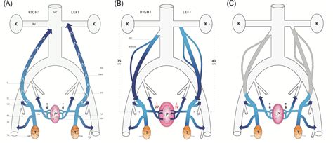 Prostatic Venous Plexus