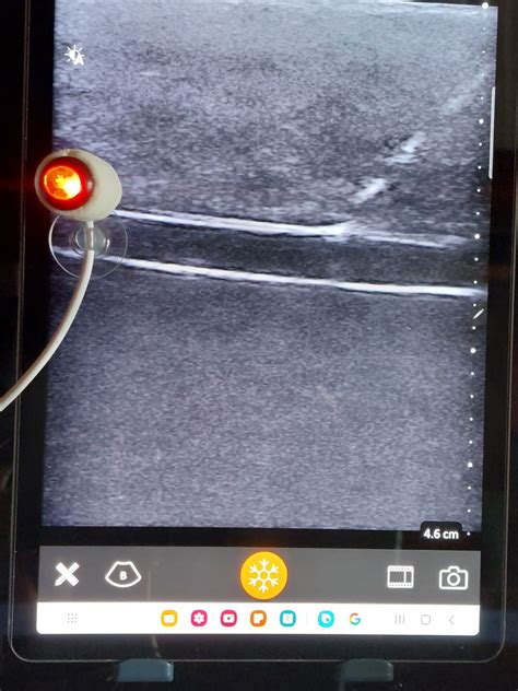 Spi Simulators On Linkedin Introducing Our New Nerve Proximity