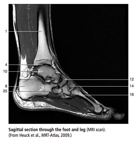 Diagram Of Foot Mri Quizlet