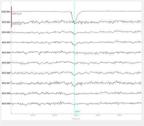 Repairing Artifacts With Regression — Mne 1101 Documentation