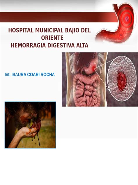 Isa Hemorragia Digestiva Alta Pdf Enfermedades Y Trastornos