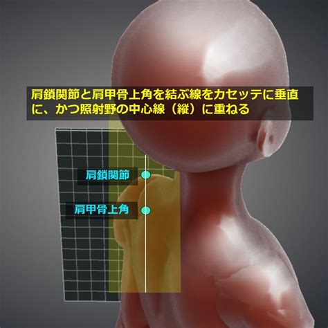 肩関節側面撮影 Shoulder Joint Lateral View Scapula Y View ｜tools For Radtech