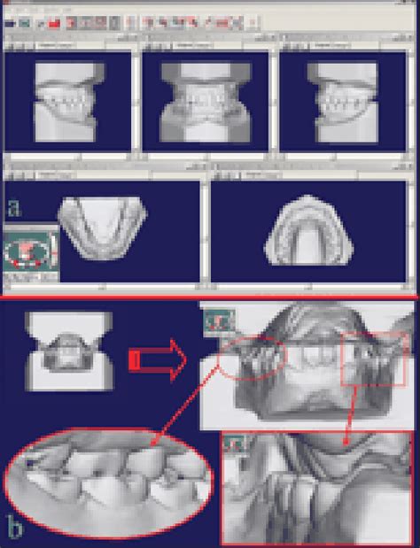 Orthocad Digital Study Model Download Scientific Diagram