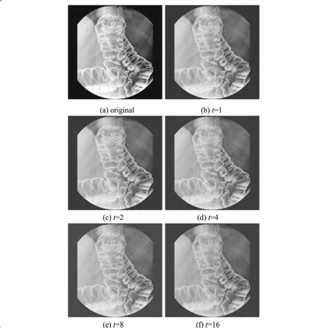 Comparison Of The Reconstructed Images With Different Dimensions Of
