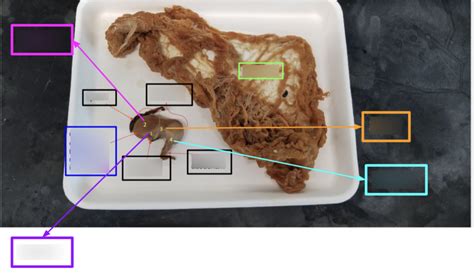 PATH 2100 Lab Practicum 3 Pt 3 Diagram Quizlet PATH 2100 Lab Practicum 3 Pt 3 Diagram Quizlet