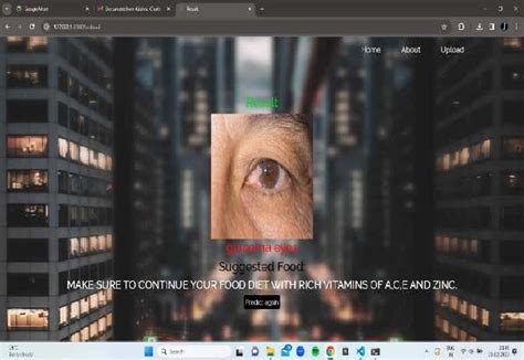 Figure 6 12 From Vitamin Deficiency Detection Using Neural Networks Semantic Scholar