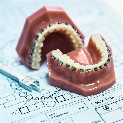 Tooth Alignment Sunset Dentistry