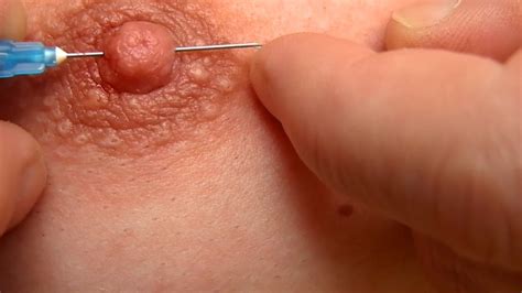 长串和针灸针 Xhamster