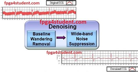 Vhdl Implementation Of Fir Filter For Ecg Denoising Rece