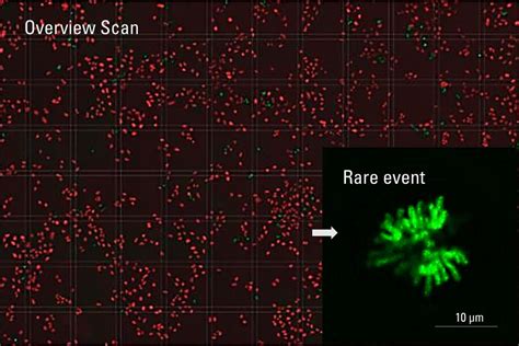 Ai Microscopy Enables The Efficient Detection Of Rare Events Learn And Share Leica Microsystems